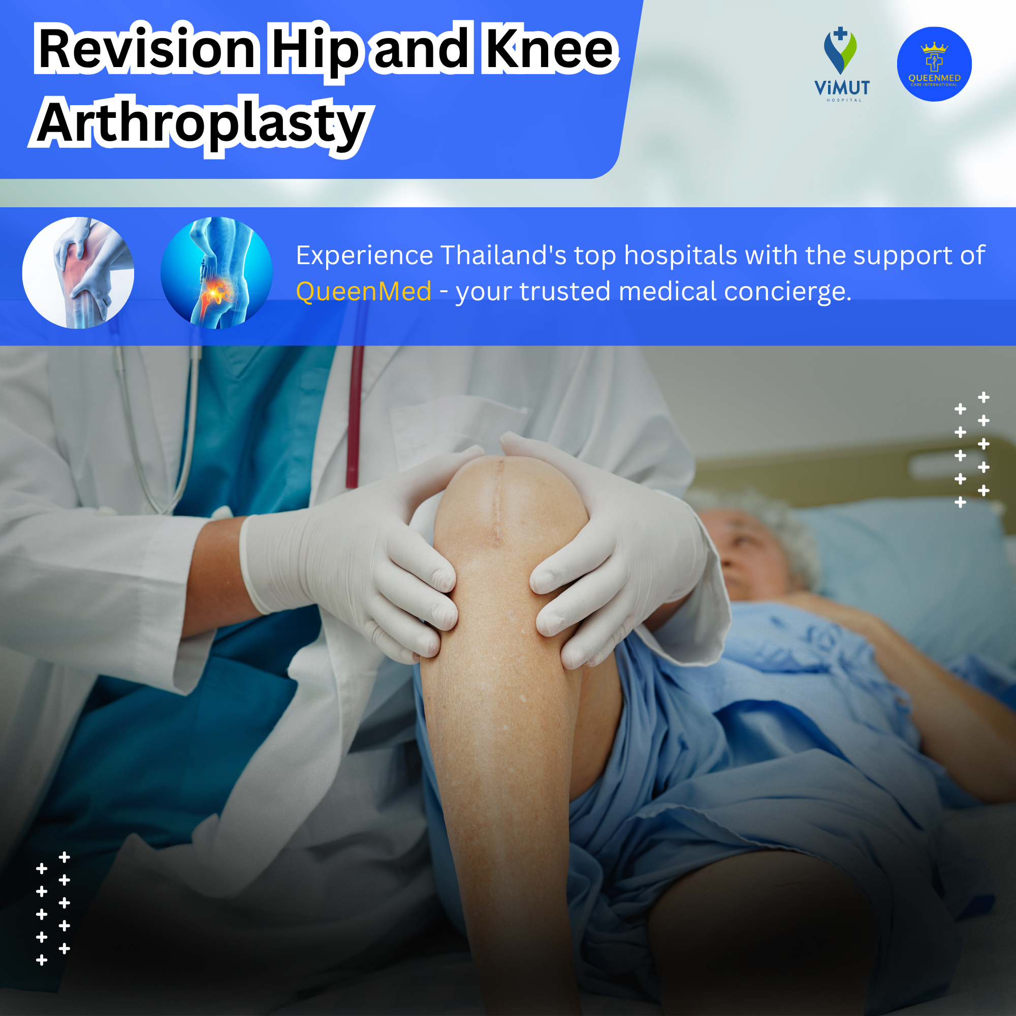 Revision Hip and Knee Arthroplasty - Queenmed Group
